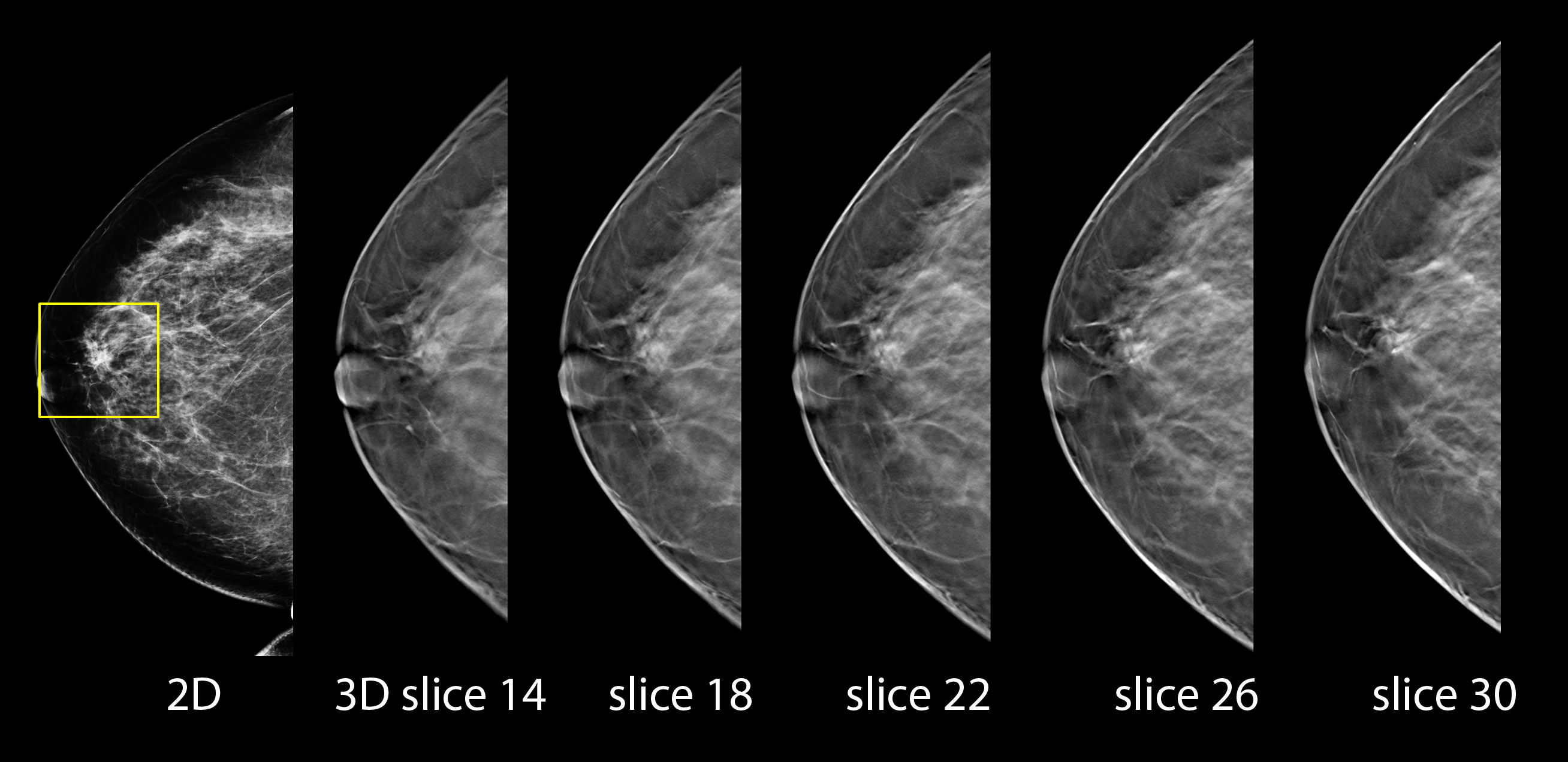 Selenia Dimensions | 3D Mammography | Hologic Selenia Dimensions | 3D Mammography | Hologic
